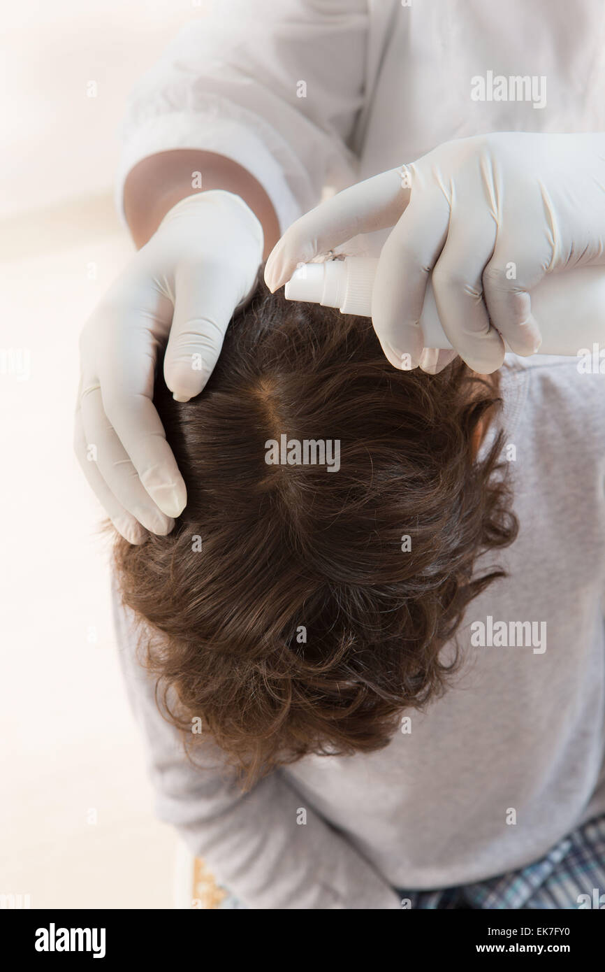 Treatment louse child Stock Photo - Alamy