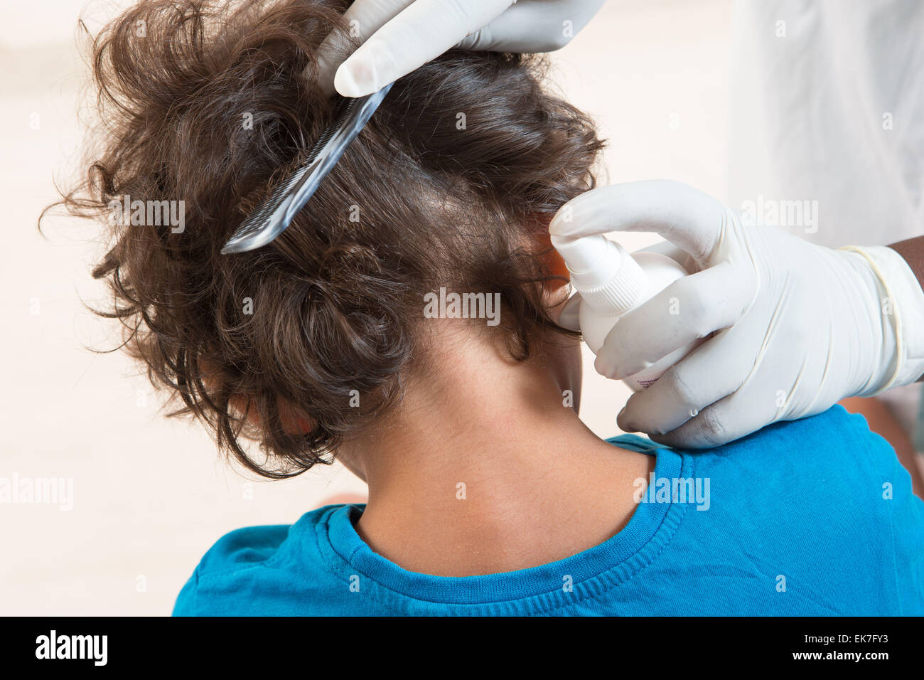 Treatment louse child Stock Photo - Alamy