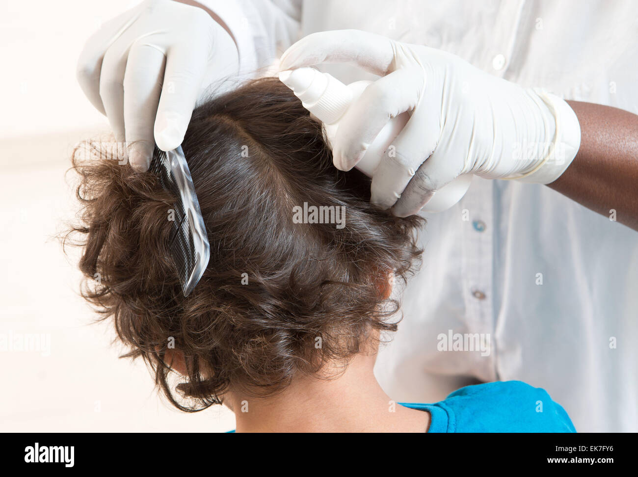 Treatment louse child Stock Photo - Alamy