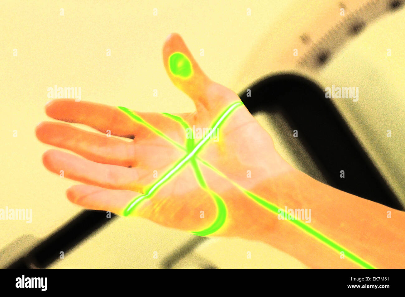 Hand and upper limb surgery hi-res stock photography and images - Alamy