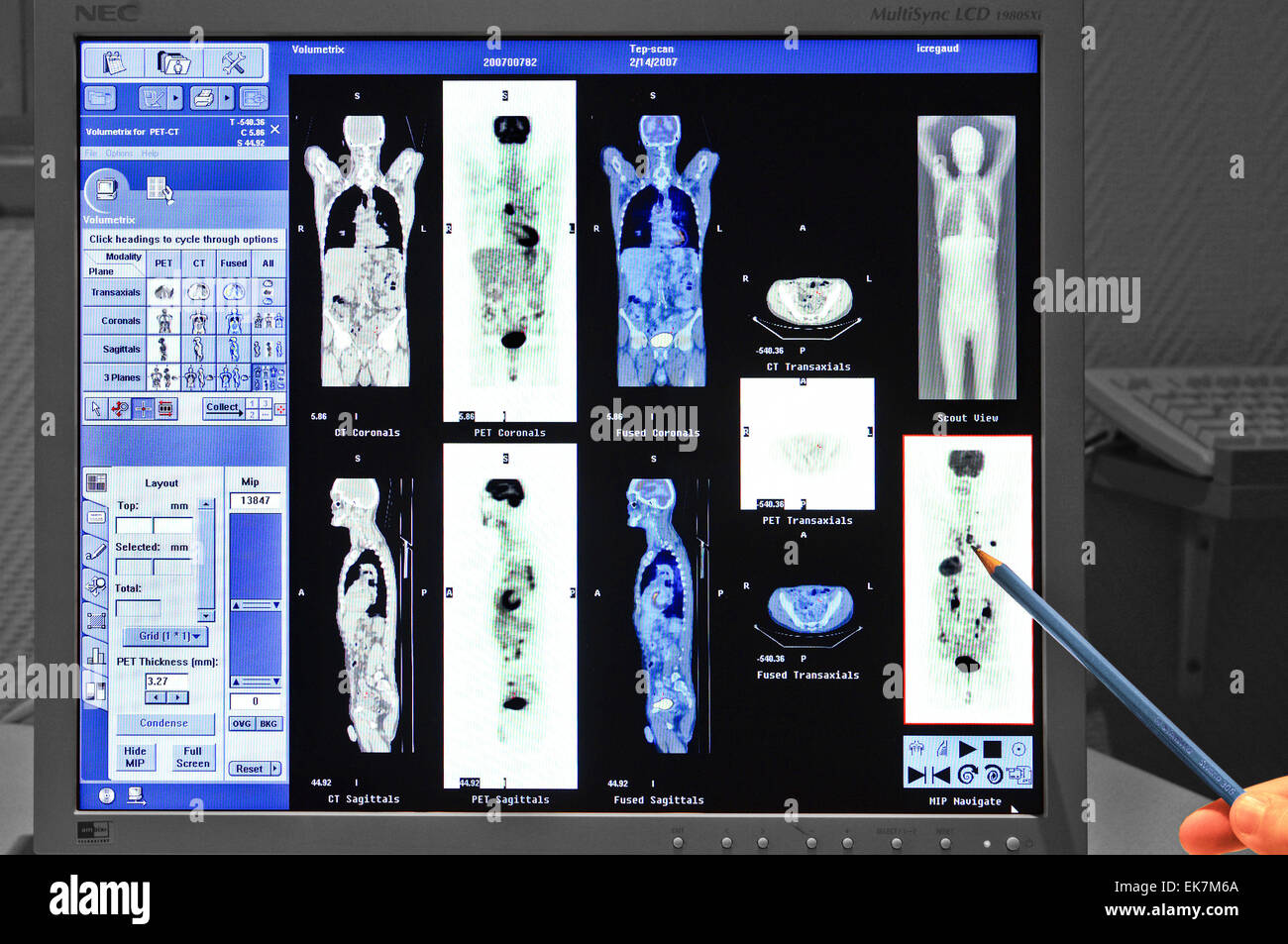 Positron Stock Photos & Positron Stock Images - Alamy