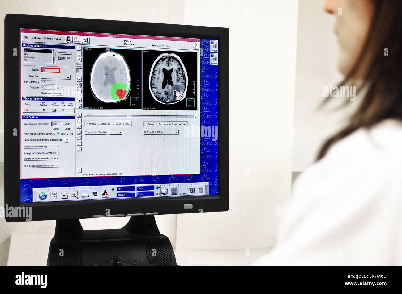 Nuclear magnetic resonance brain hi-res stock photography and images ...