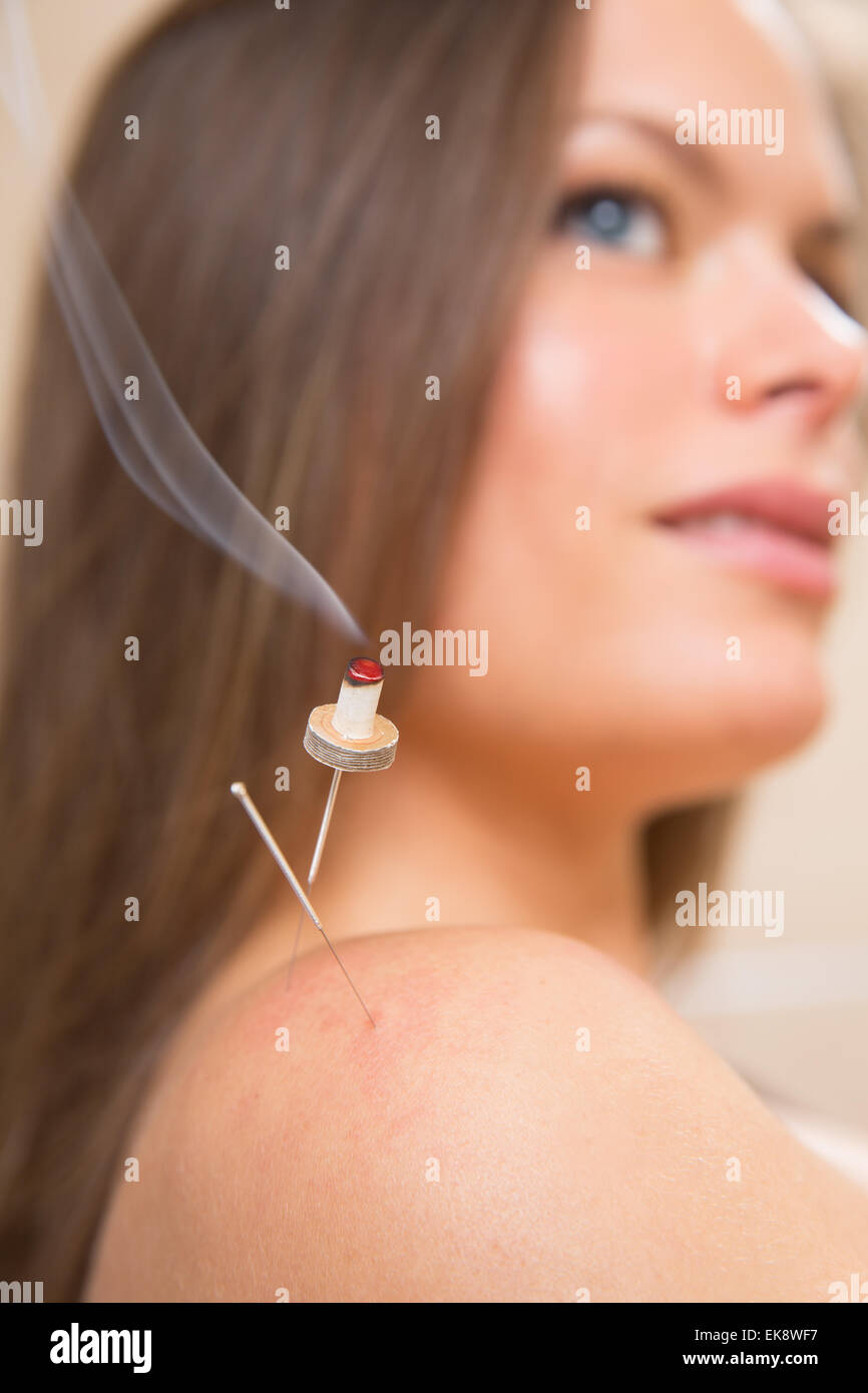 Acupunture needle hi-res stock photography and images - Alamy