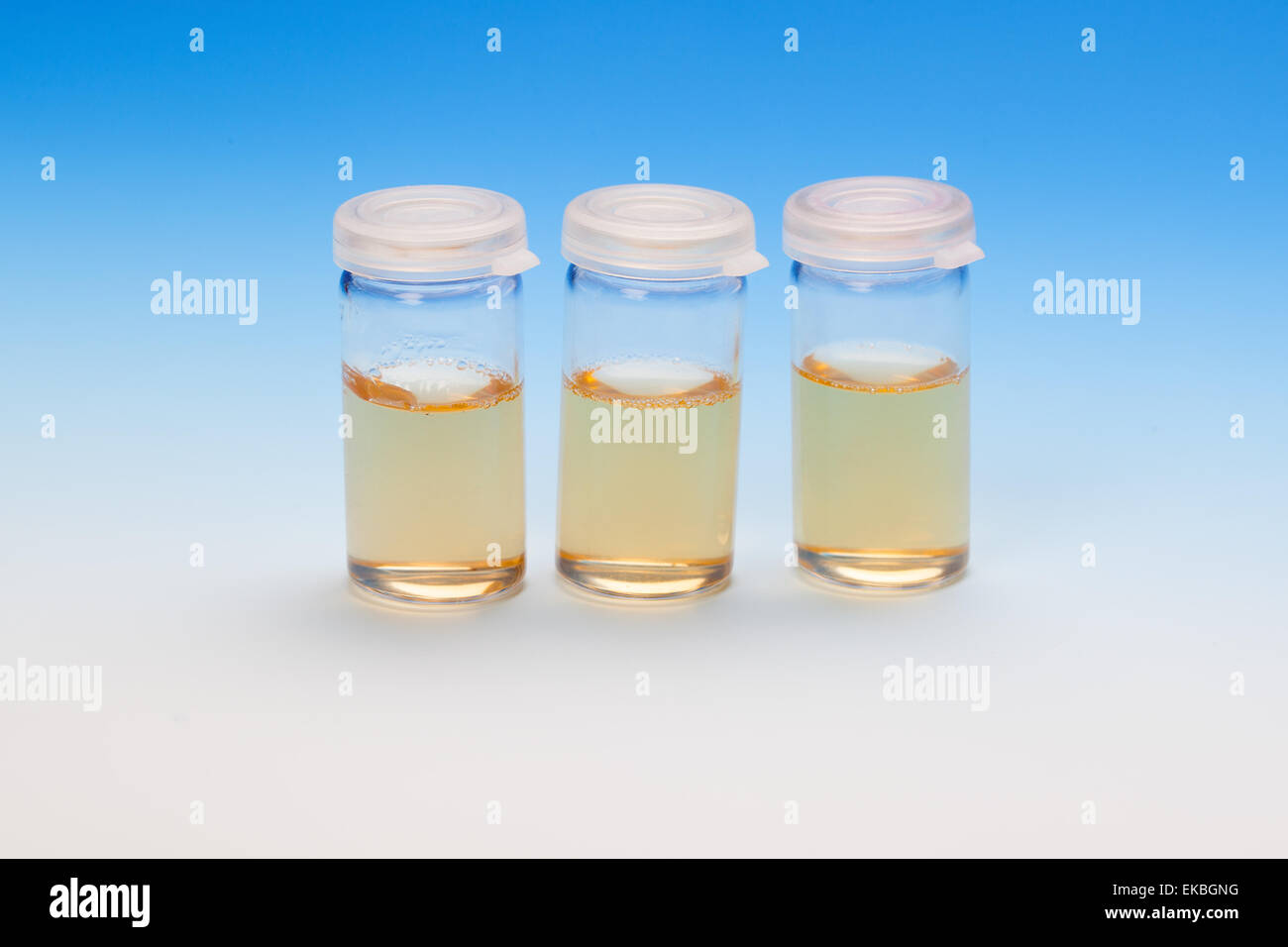 Three liquid samples in plastic vials. biological laboratory Stock ... Three liquid samples in plastic vials. biological laboratory Stock ...