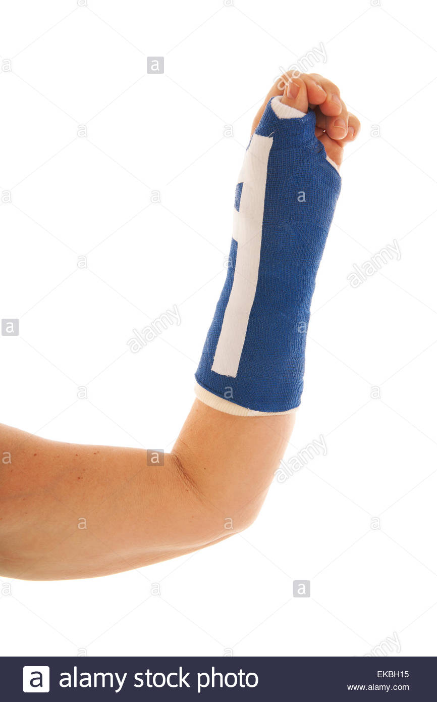 Wrist Plaster Stock Photos & Wrist Plaster Stock Images - Alamy