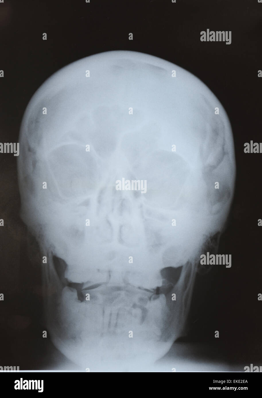 Head shot teeth hi-res stock photography and images - Alamy