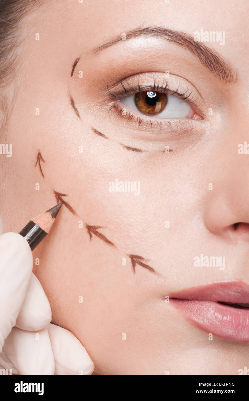 Correction lines on woman face, before surgery operetion Stock Photo ...