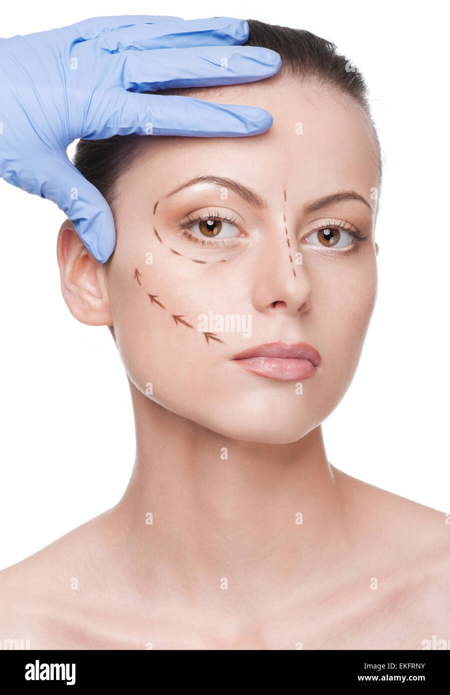 Correction lines on woman face, before surgery operetion Stock Photo ...