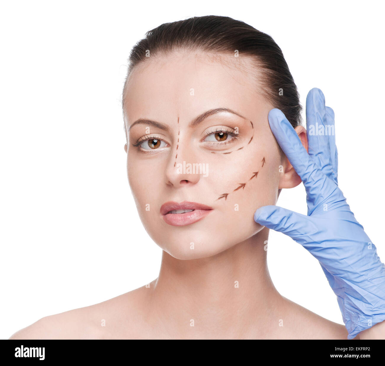 Correction lines on woman face, before surgery operetion Stock Photo ...