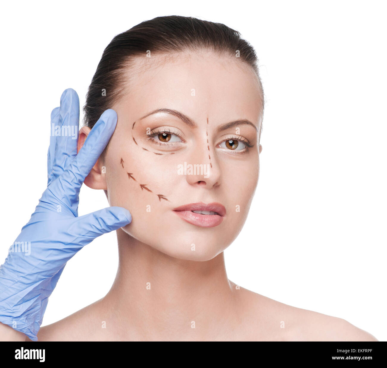 Correction lines on woman face, before surgery operetion Stock Photo ...