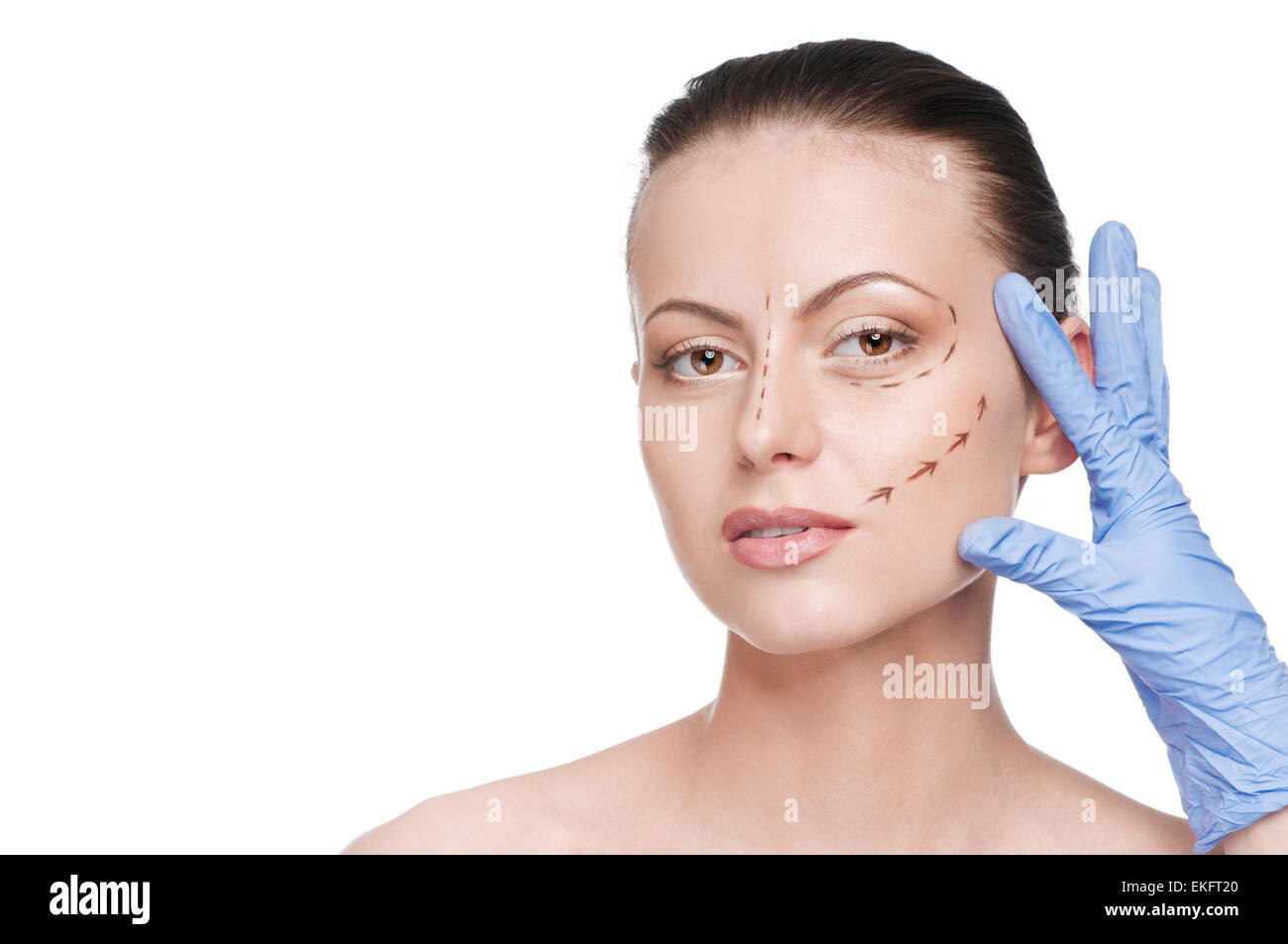 Correction lines on woman face, before surgery operetion Stock Photo ...