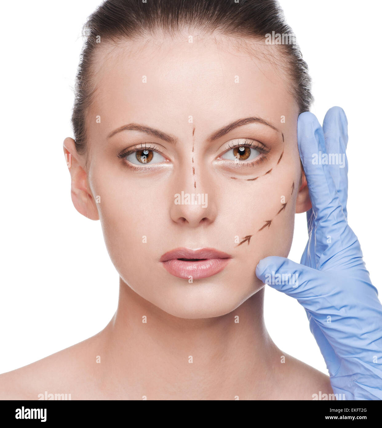 Correction lines on woman face, before surgery operetion Stock Photo ...