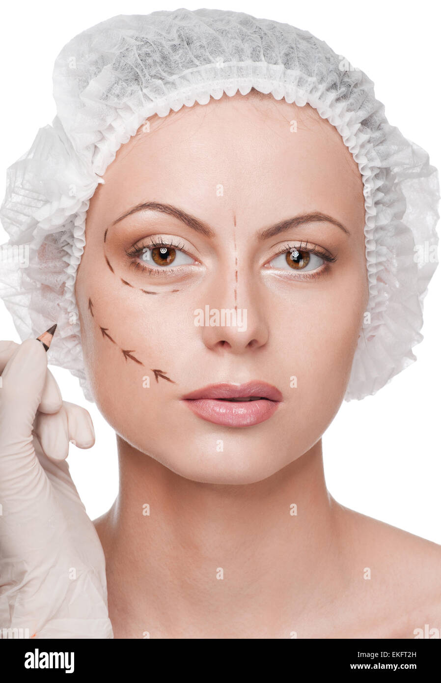 Correction lines on woman face, before surgery operetion Stock Photo ...