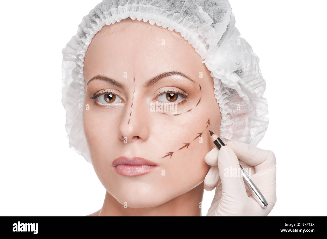 Correction lines on woman face, before surgery operetion Stock Photo ...