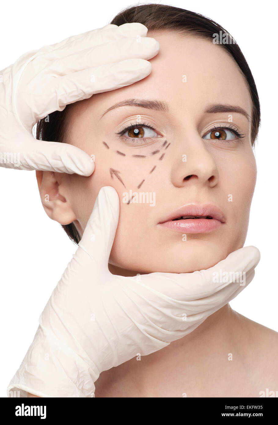 Correction lines on woman face, before surgery operetion Stock Photo ...