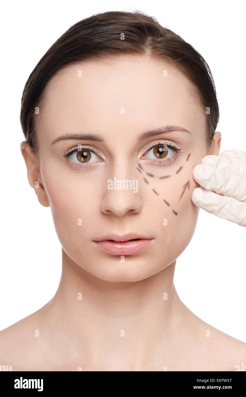 Correction lines on woman face, before surgery operetion Stock Photo ...