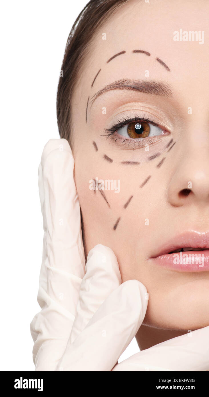 Correction lines on woman face, before surgery operetion Stock Photo ...