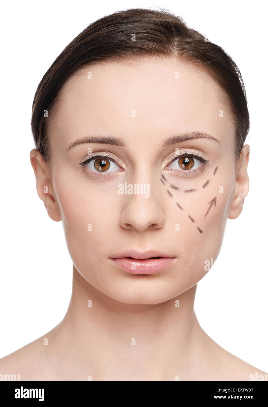 Correction lines on woman face, before surgery operetion Stock Photo ...