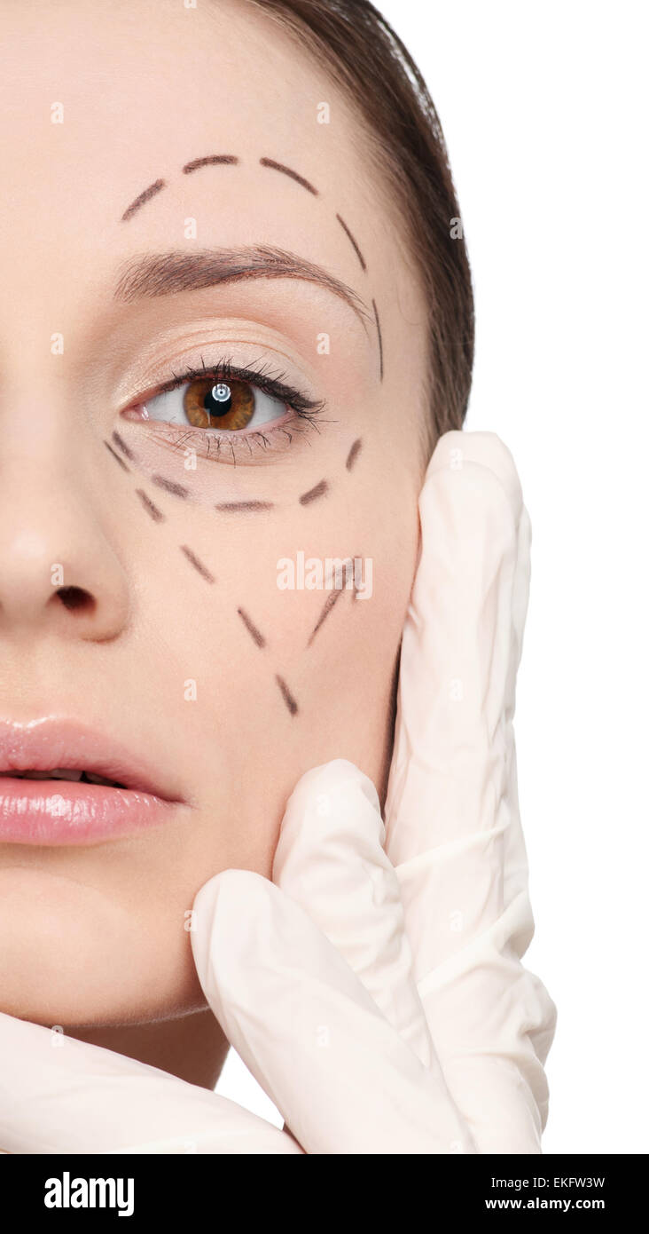 Correction lines on woman face, before surgery operetion Stock Photo ...