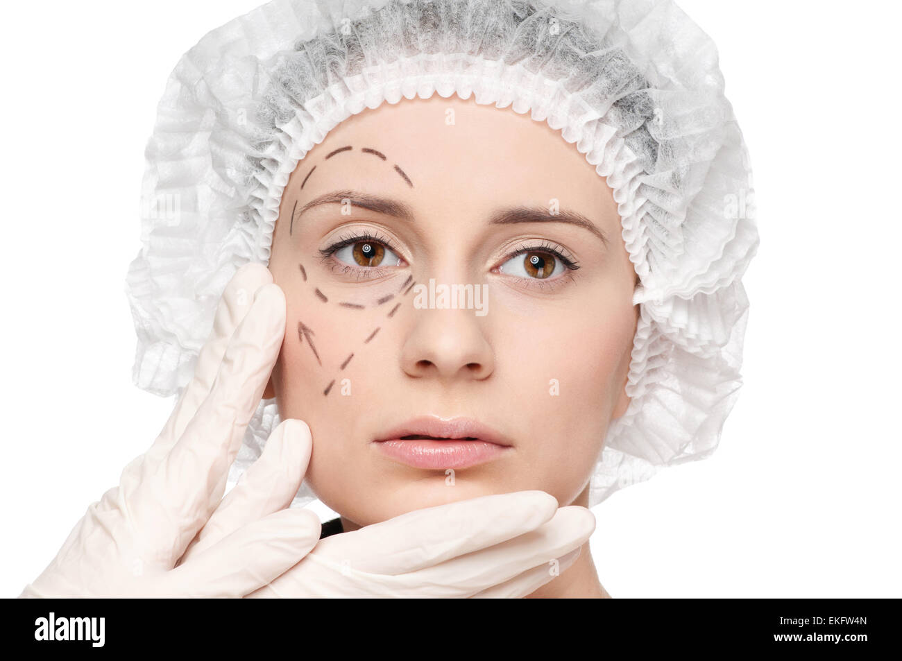 Correction lines on woman face, before surgery operetion Stock Photo ...