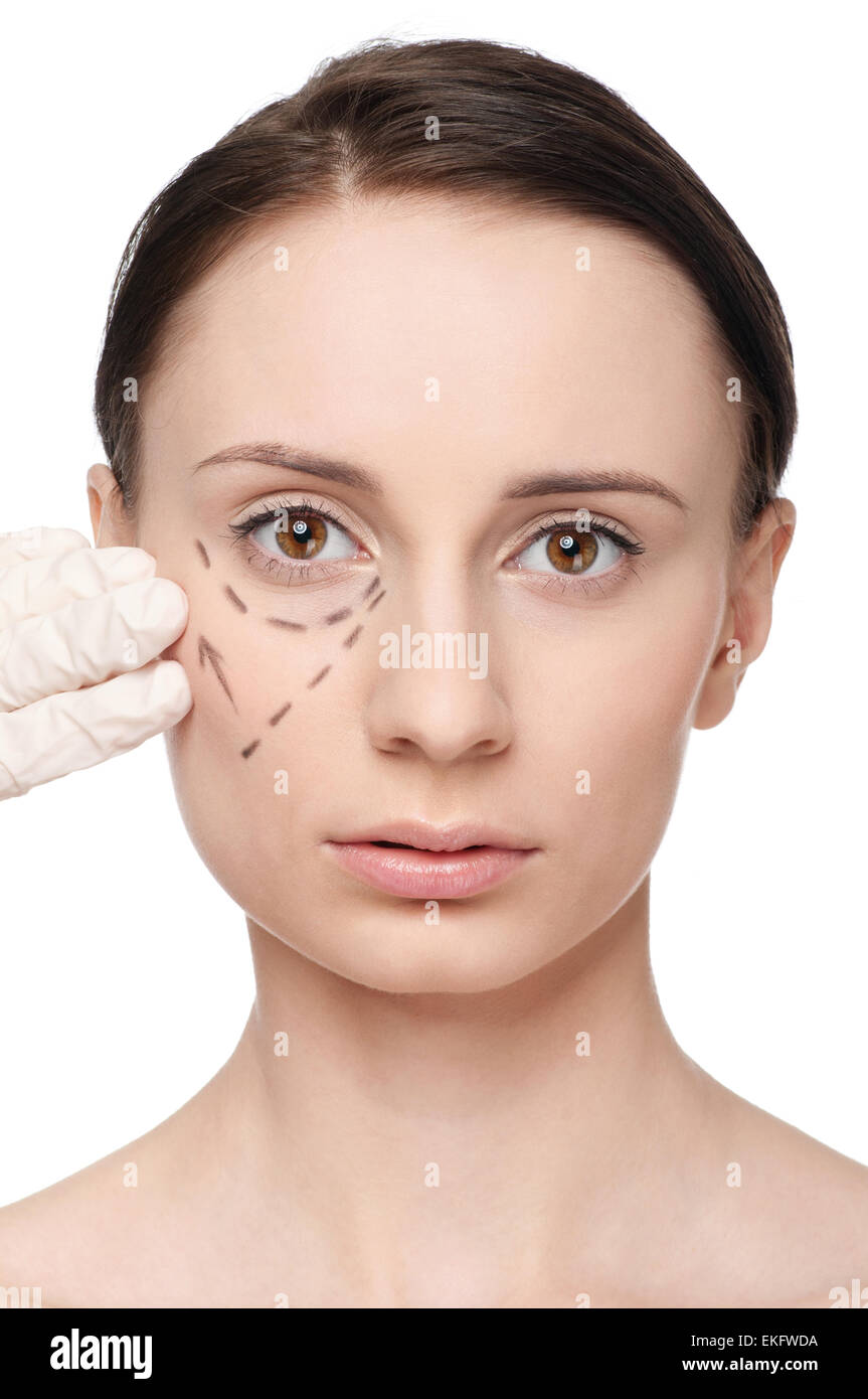 Correction lines on woman face, before surgery operetion Stock Photo ...
