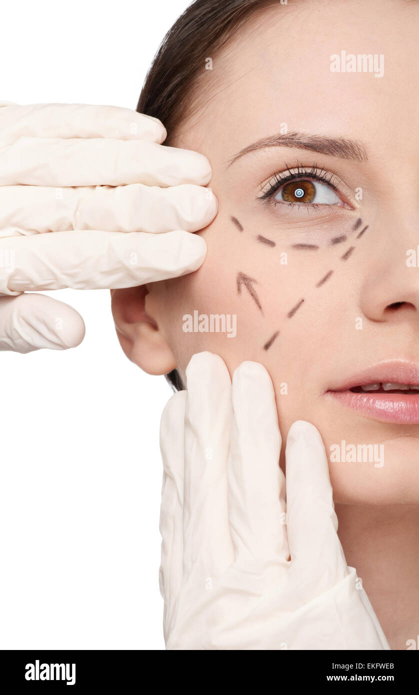 Correction lines on woman face, before surgery operetion Stock Photo ...