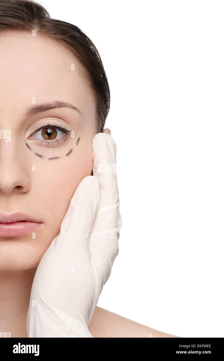 Correction lines on woman face, before surgery operetion Stock Photo ...