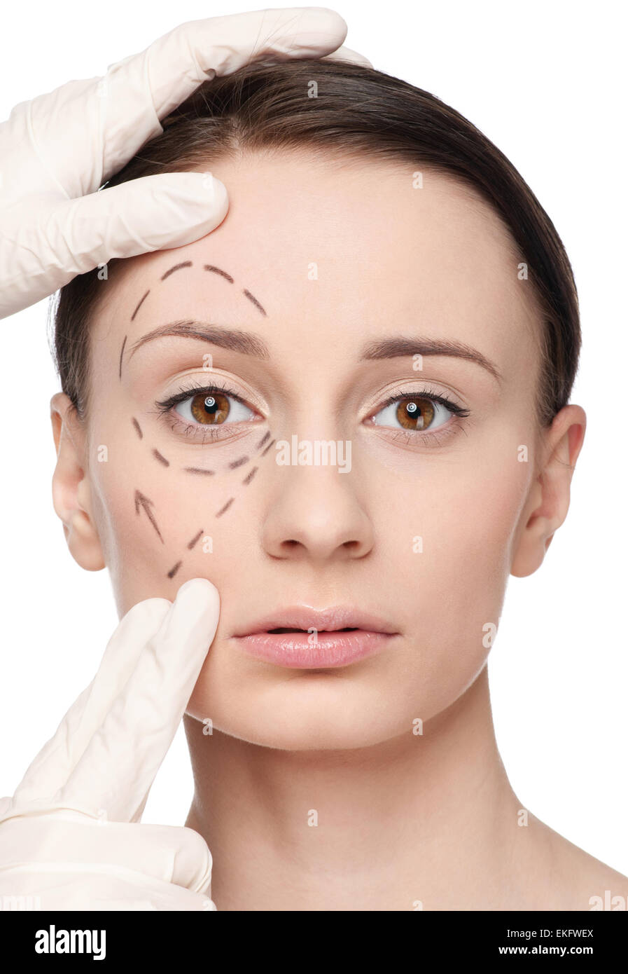 Correction lines on woman face, before surgery operetion Stock Photo ...
