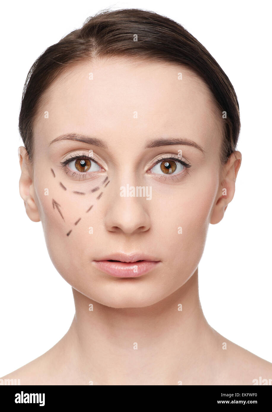 Correction lines on woman face, before surgery operetion Stock Photo ...