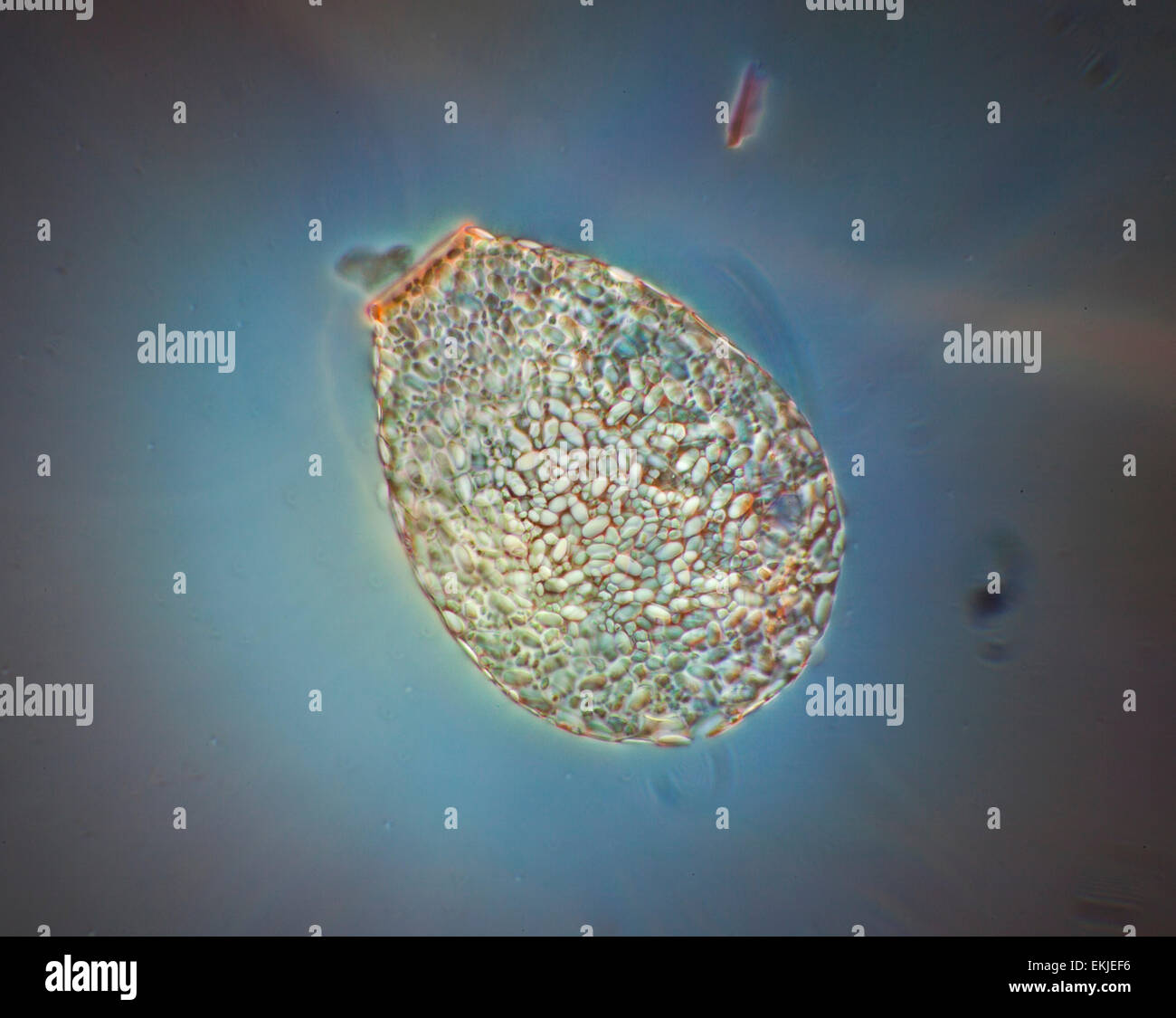 Testate amoeba darkfield photomicrograph Stock Photo - Alamy