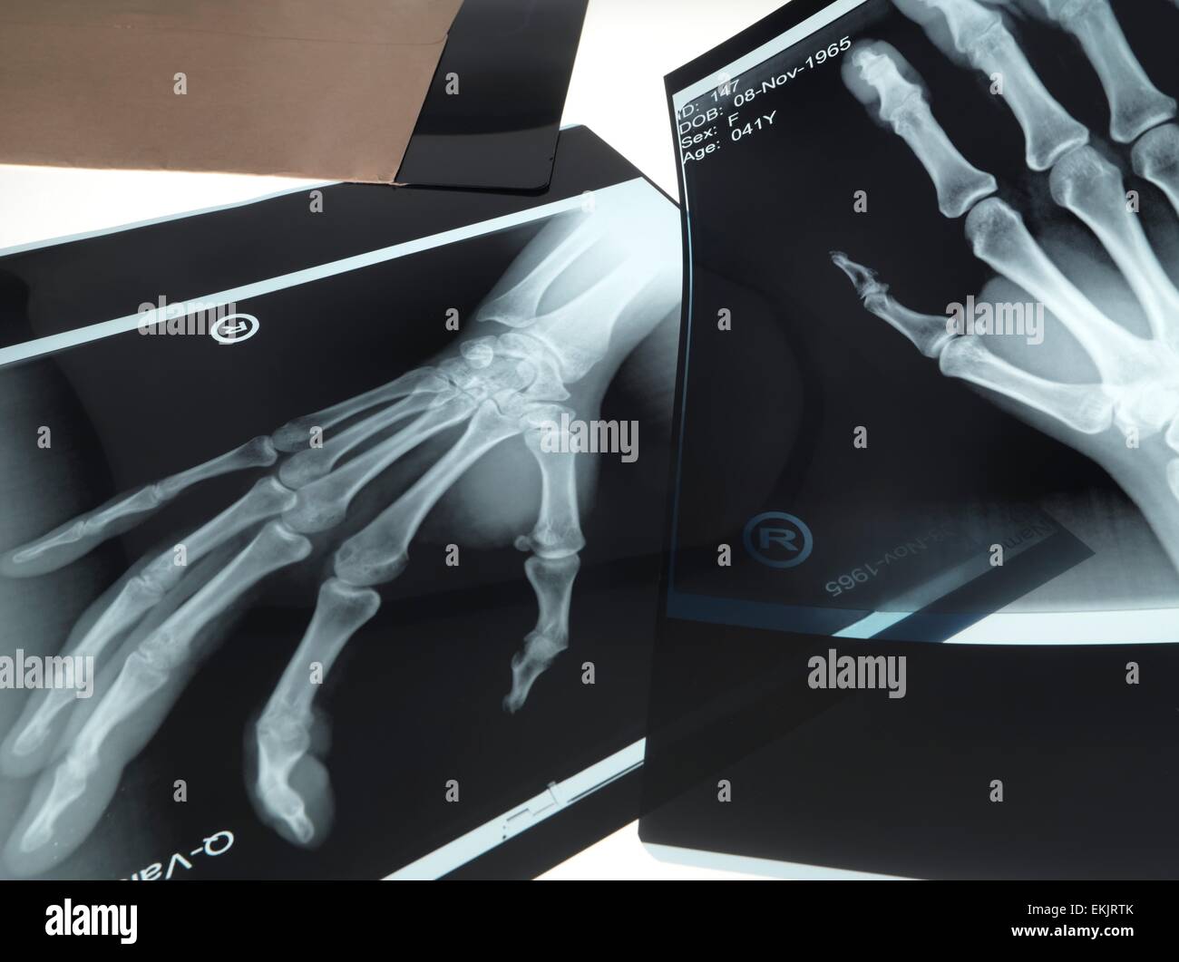 adult, bones, diagnosis, diagnostic, doctor, hand, human, medical ...