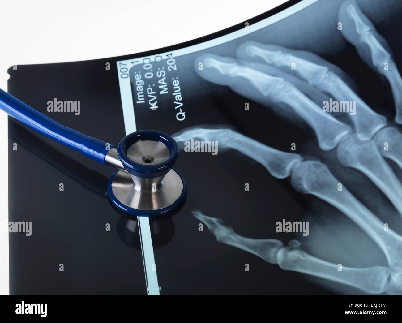 adult, bones, diagnosis, diagnostic, doctor, hand, human, medical ...