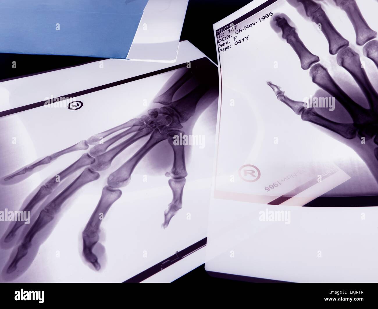 adult, bones, diagnosis, diagnostic, doctor, hand, human, medical ...