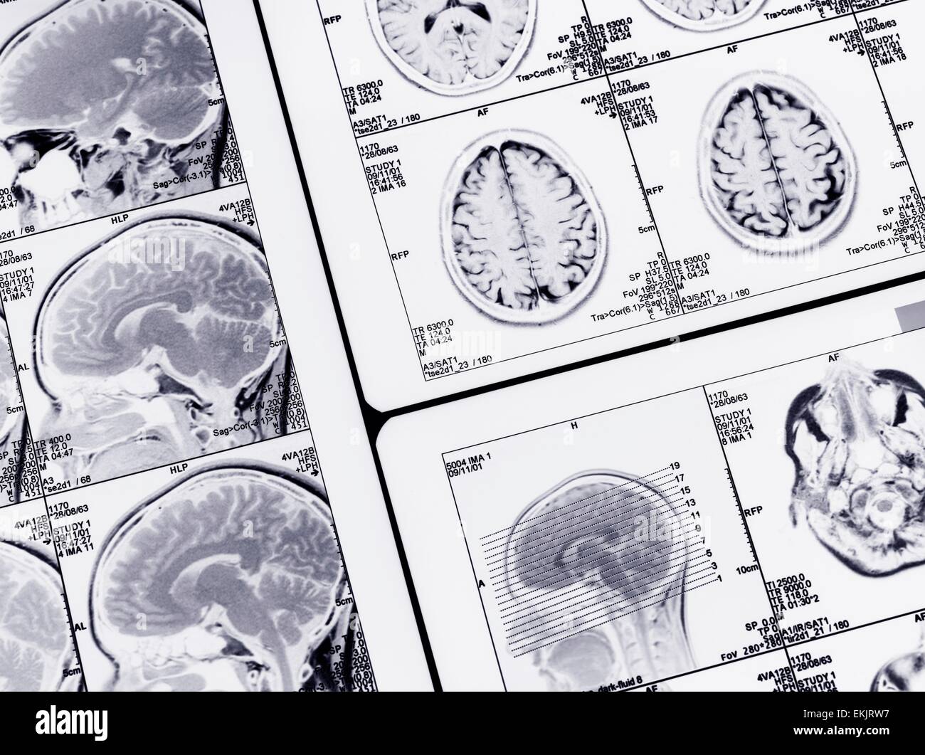brain scan, diagnosis, diagnostics, healthcare, magnetic resonance ...