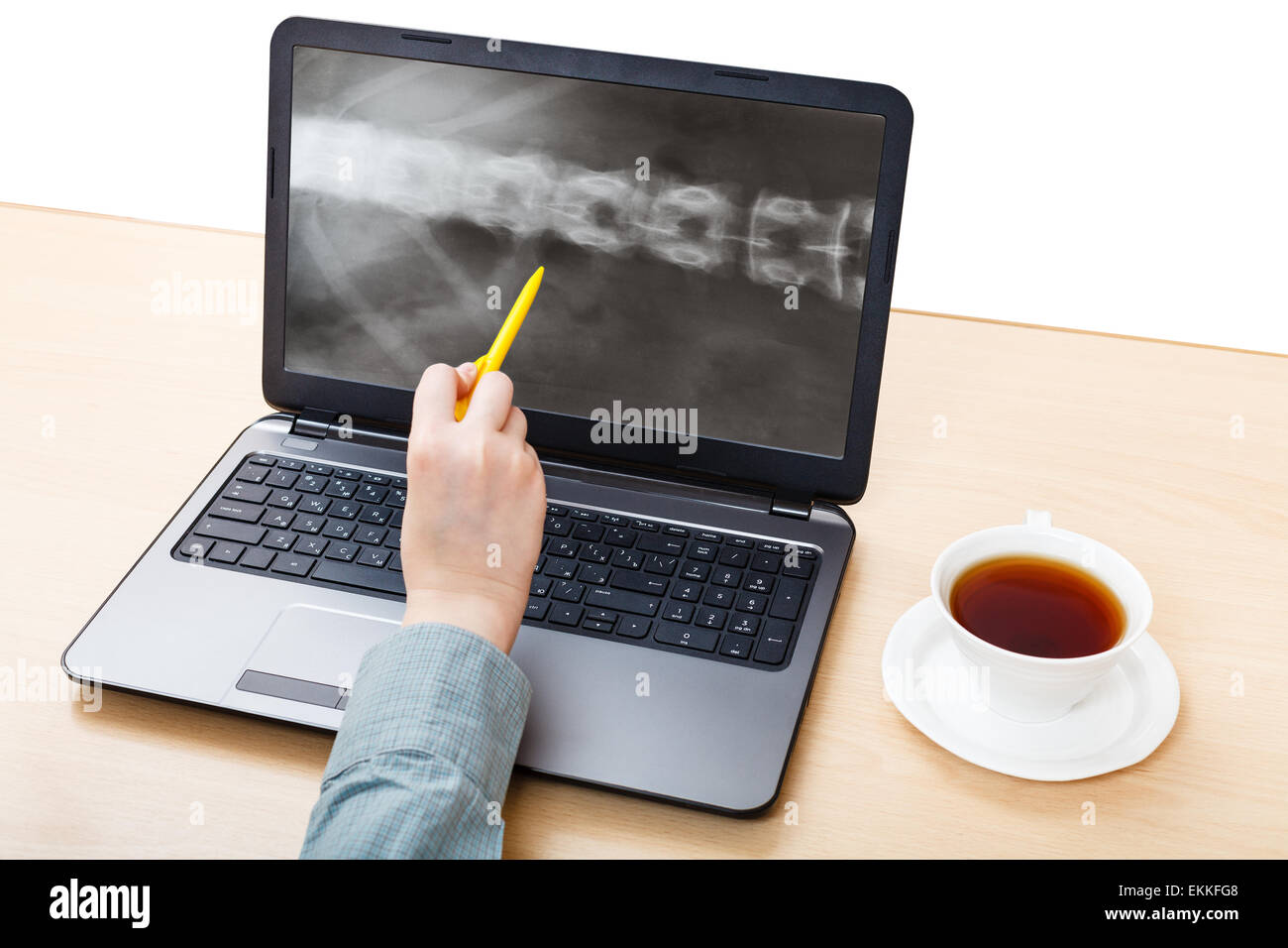 medic analyzes X-ray picture of spine on laptop screen Stock Photo - Alamy
