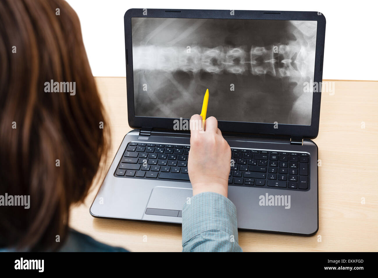 student analyzes X-ray picture of spine on laptop screen Stock Photo ...