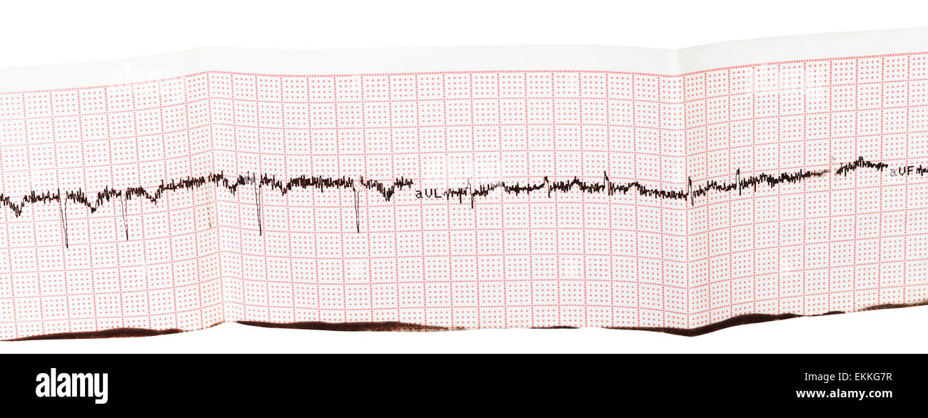 Ekg paper hi-res stock photography and images - Alamy