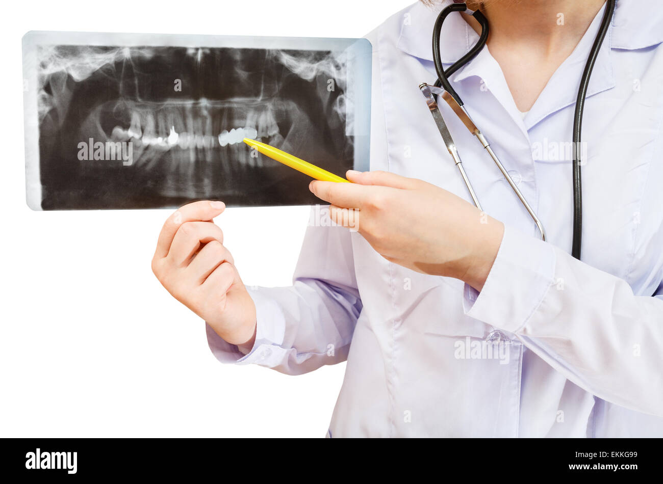nurse points X-ray picture with human jaw isolated on white background ...