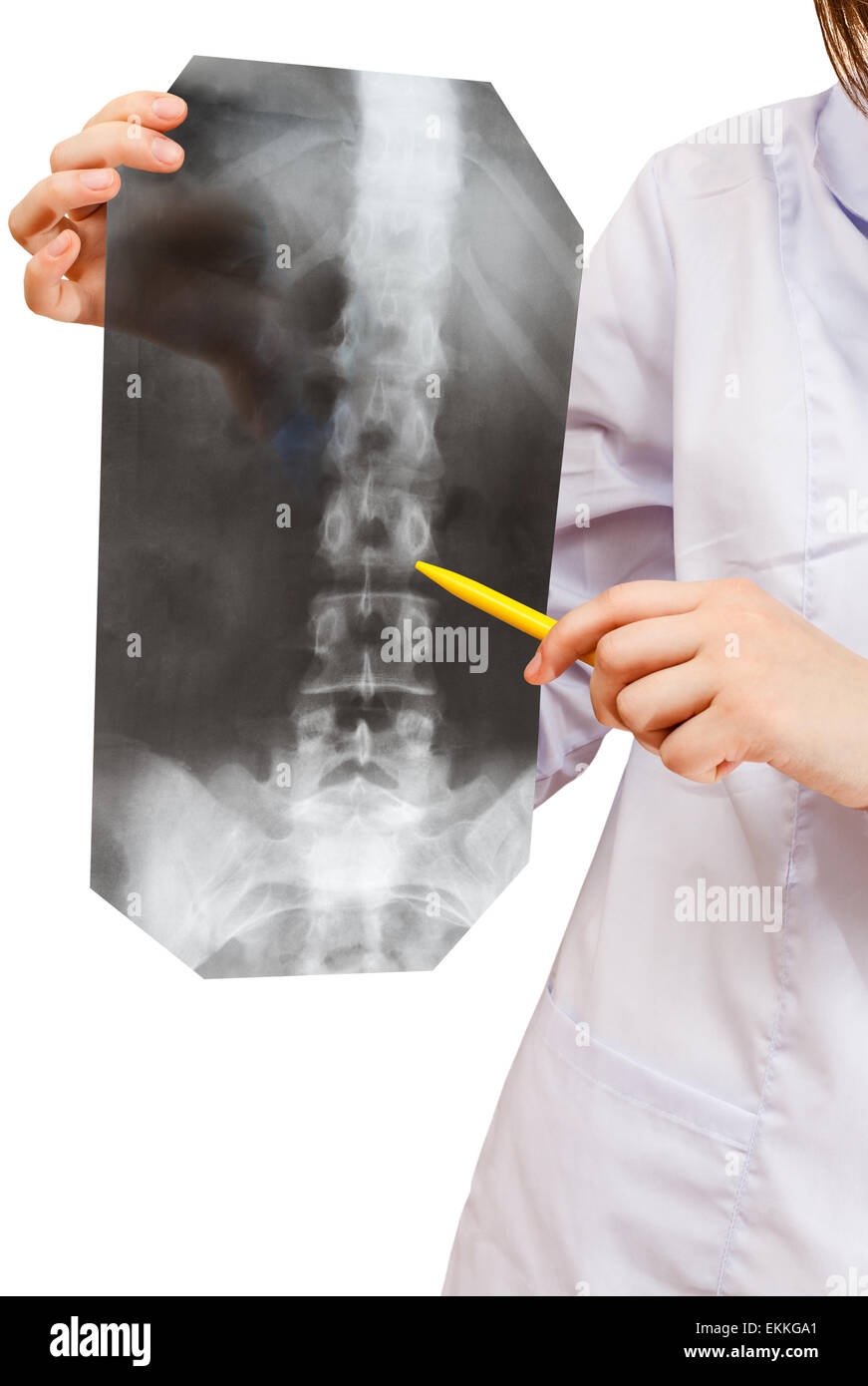Spinal radiograph hi-res stock photography and images - Alamy