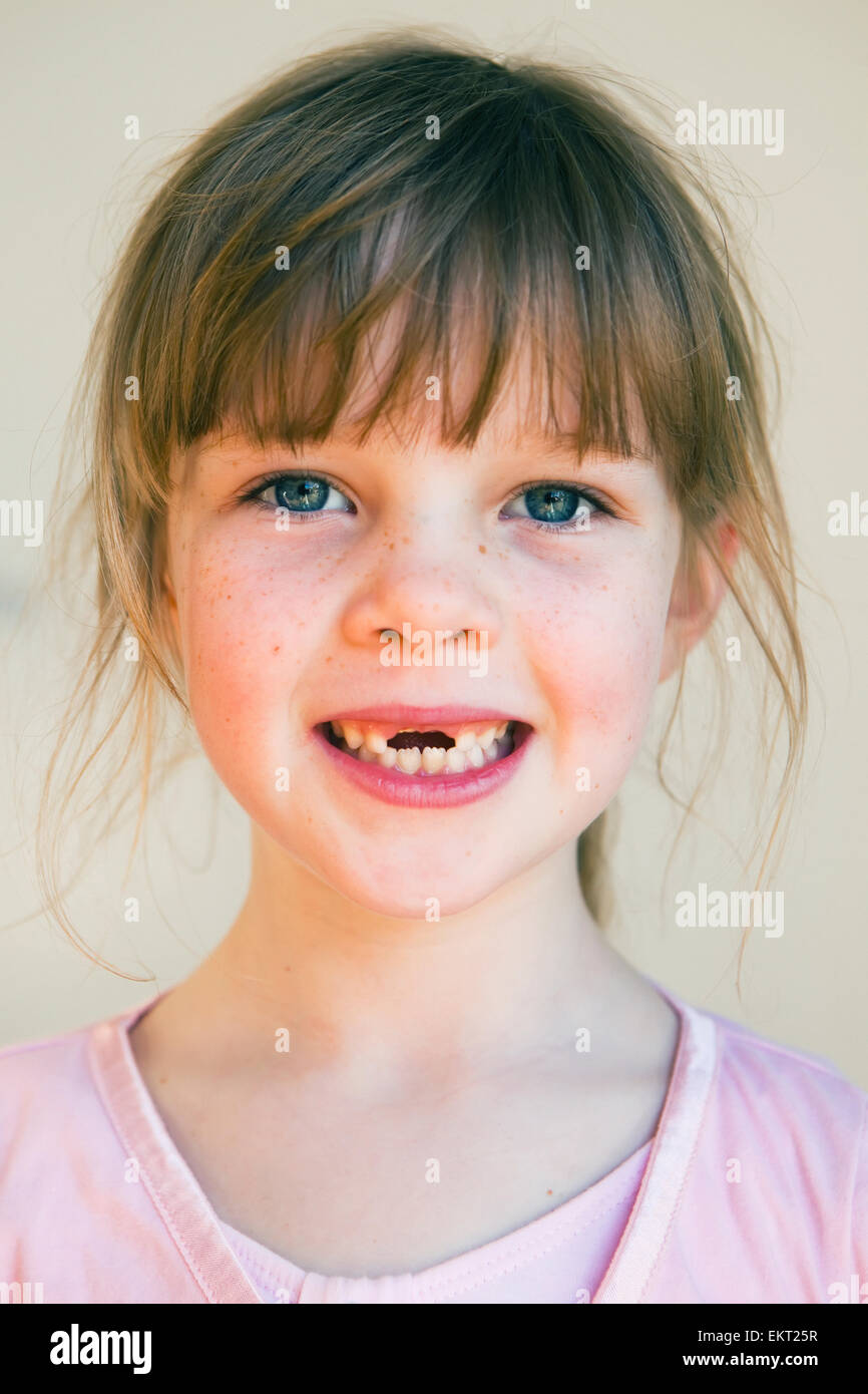 Missing front hi-res stock photography and images - Alamy