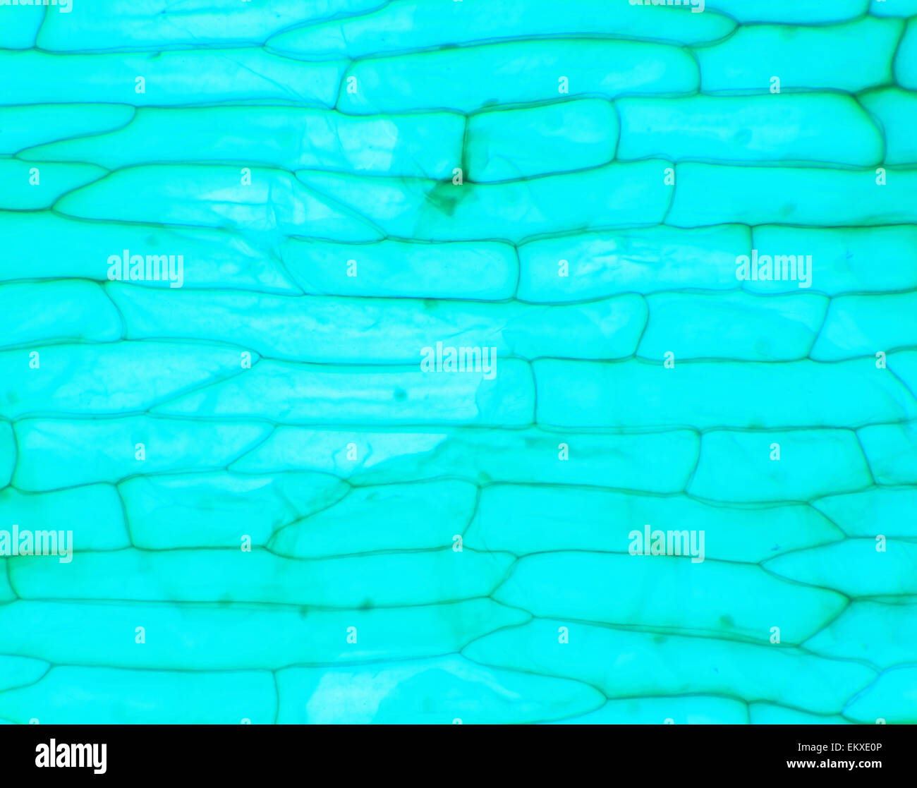Rhode flagellate protozoa under a microscope (Allium Scale Euglena W.M ...