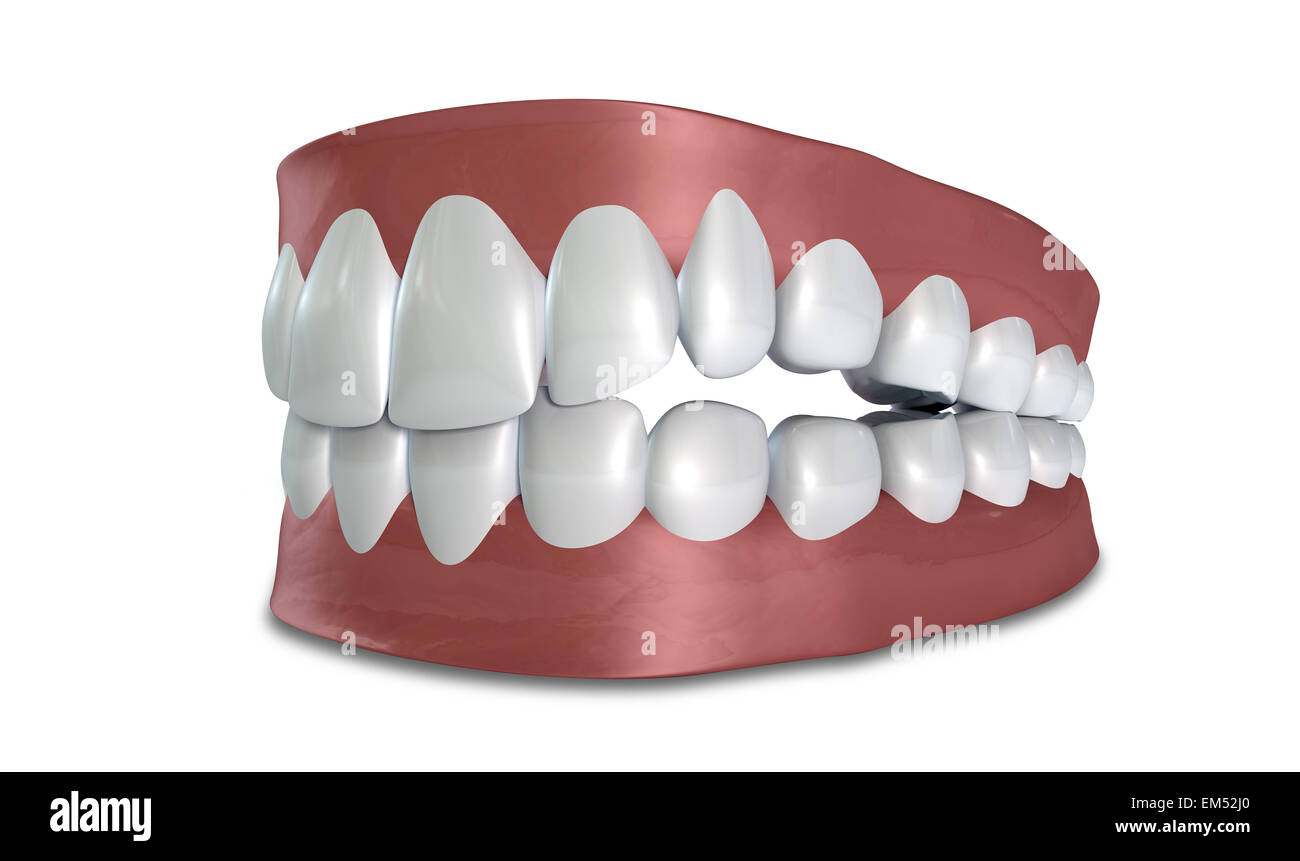 Dental set of teeth hi-res stock photography and images - Alamy