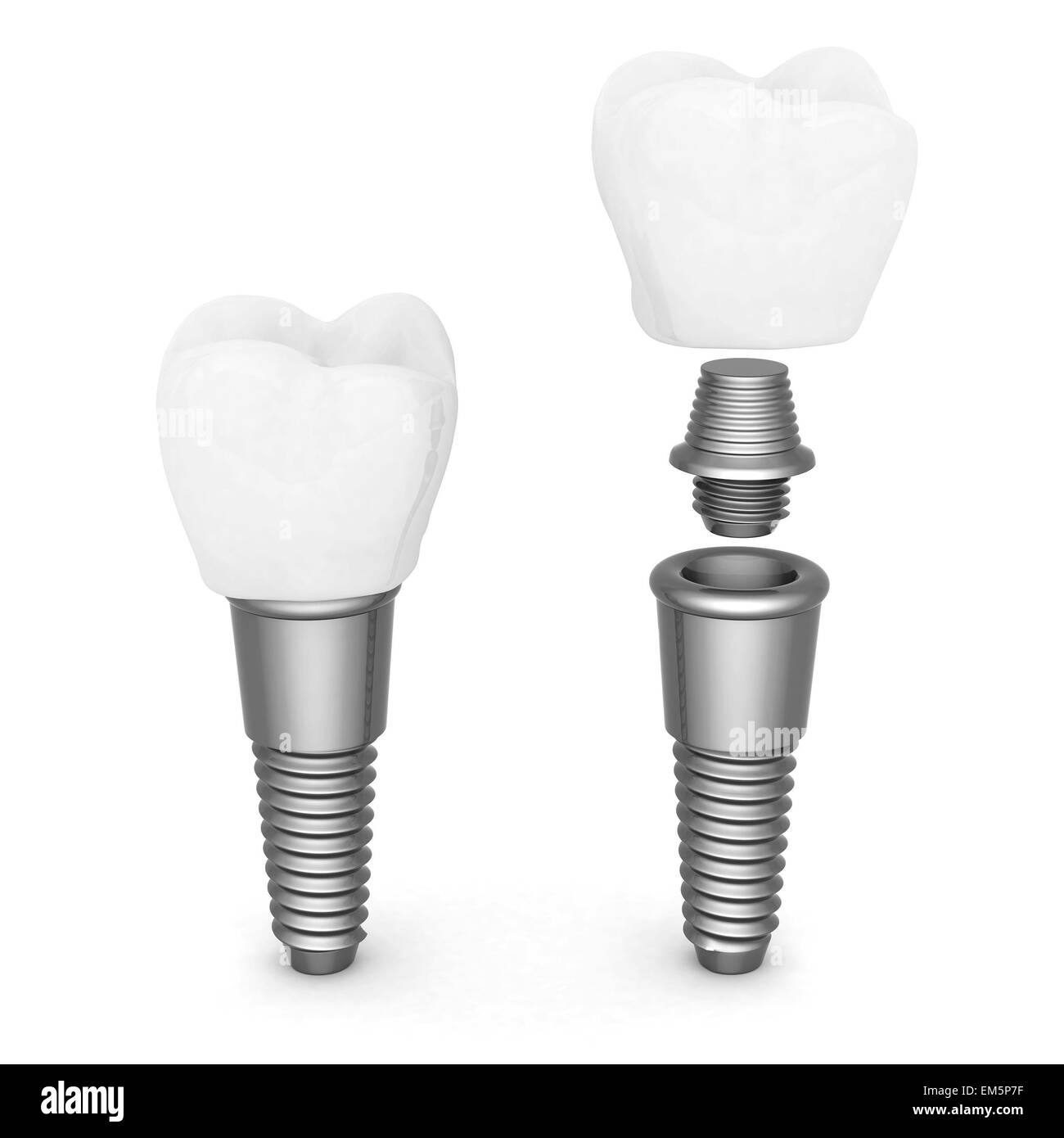 Dental implant denture on Black and White Stock Photos & Images - Alamy