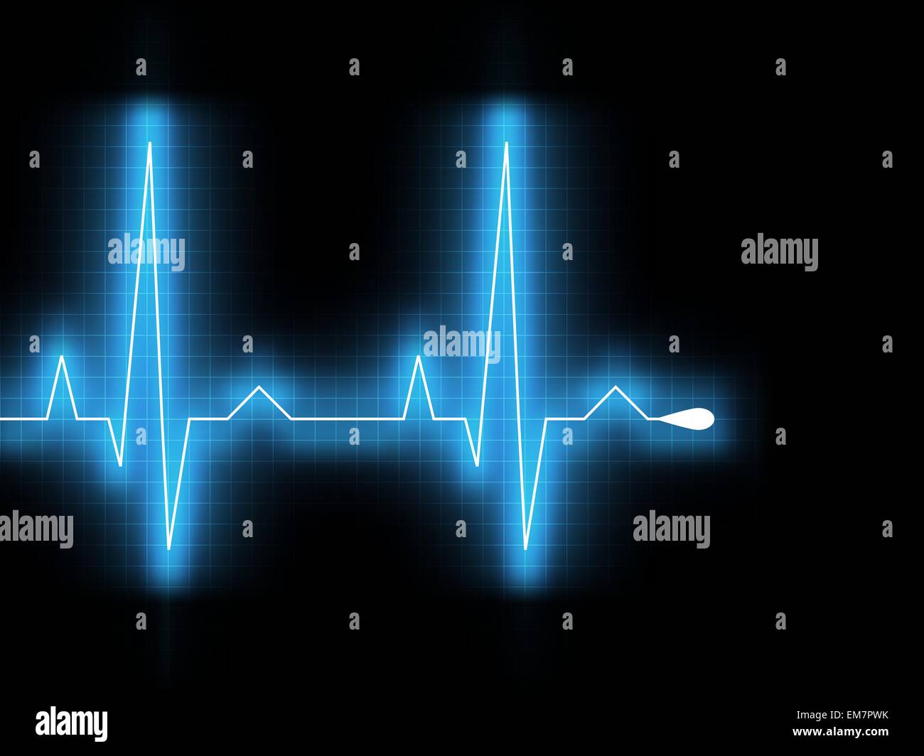 Heartbeat monitor hi-res stock photography and images - Alamy