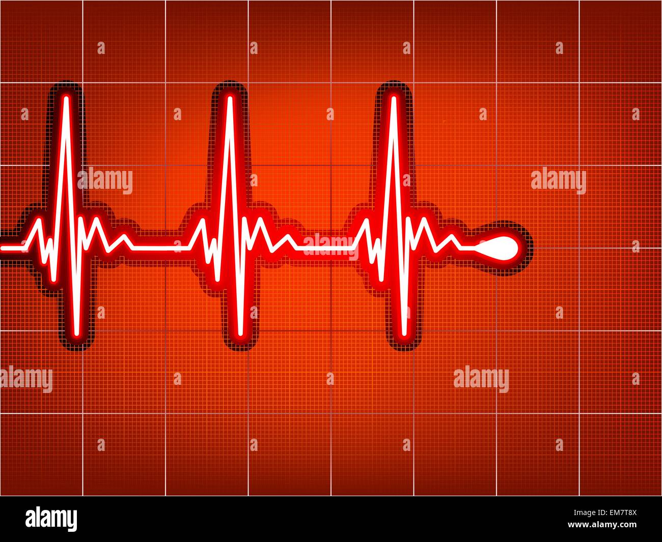 Electrocardiogram examination Stock Vector Images - Alamy