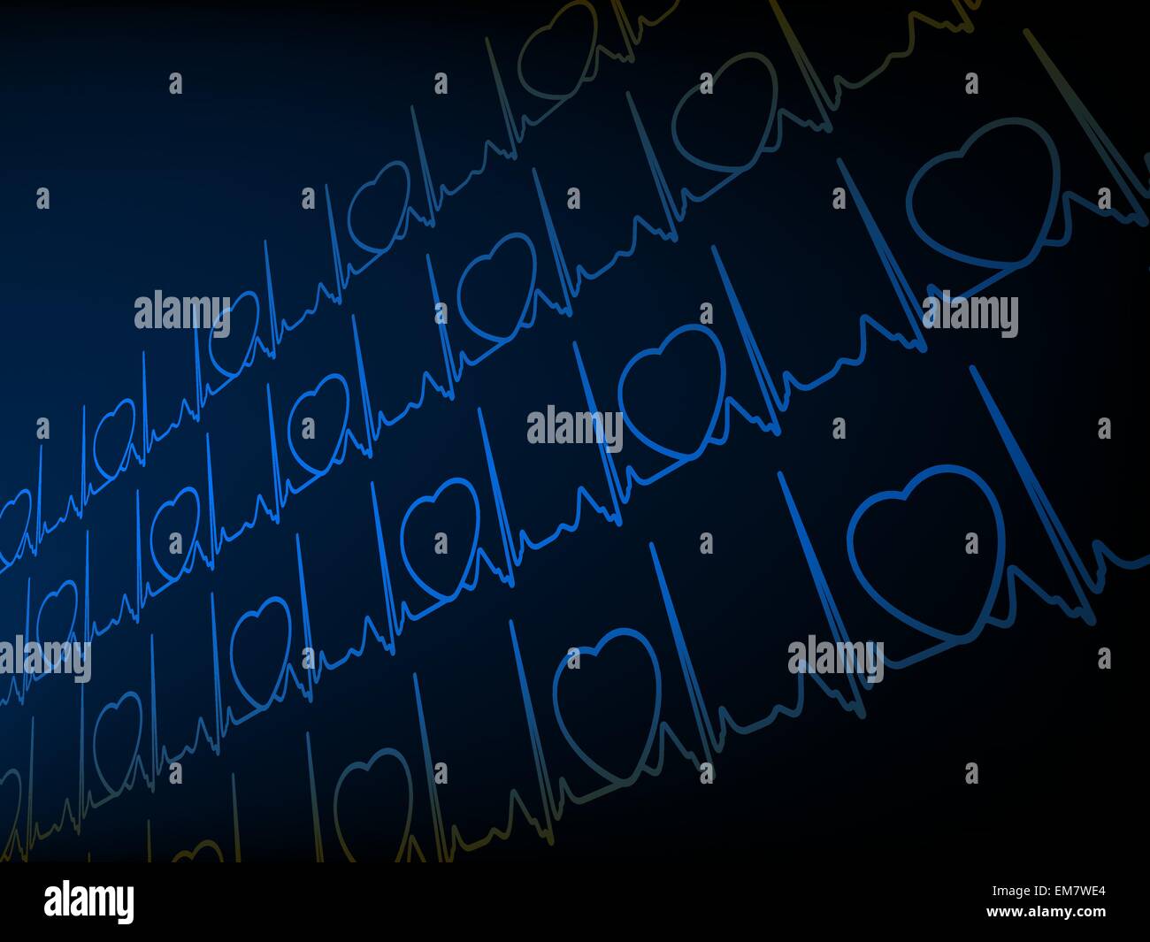 Ecg tracing hi-res stock photography and images - Alamy