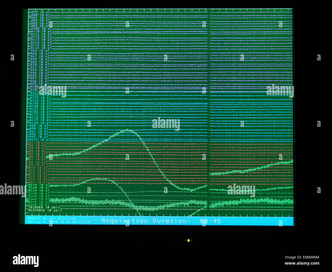 Brain monitor communication hi-res stock photography and images - Alamy