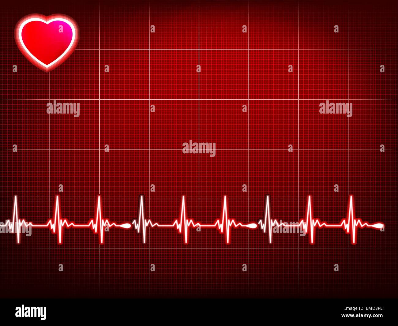 Normal ecg Stock Vector Images - Alamy