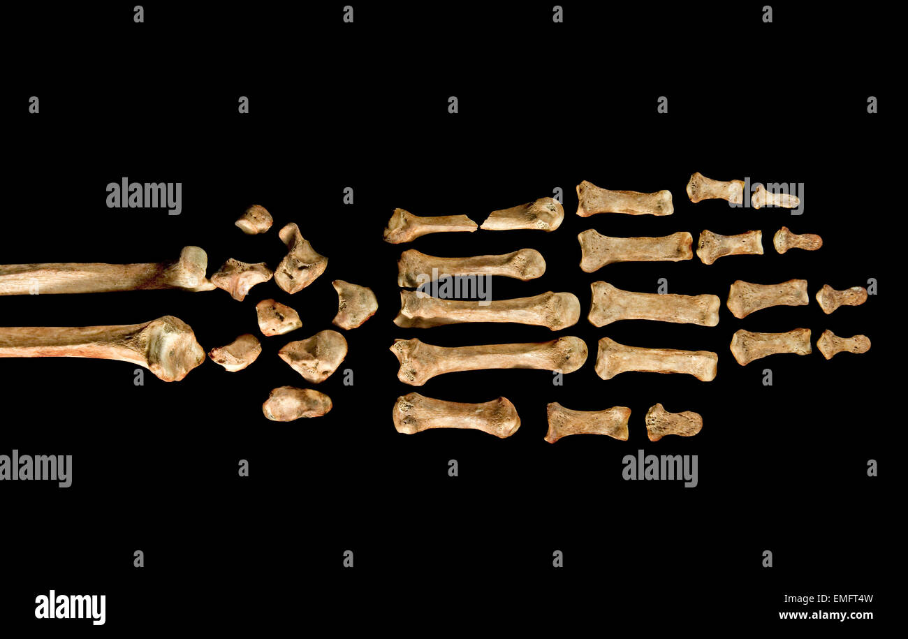 Protohistory female hand bones at Batujaya archaeological site in ...