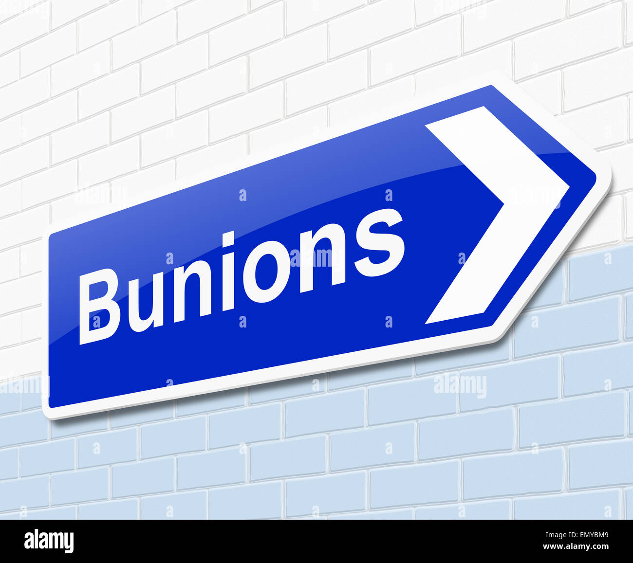 Bunions hi-res stock photography and images - Alamy